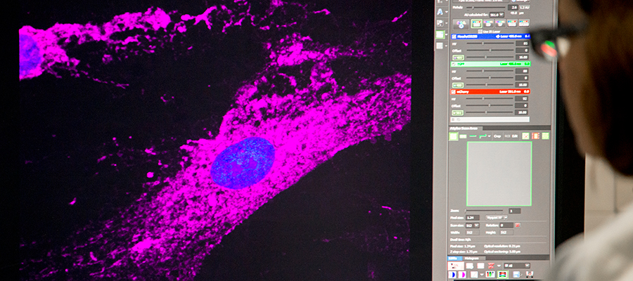 Advanced Imaging Resource | Institute of Genetics and Cancer