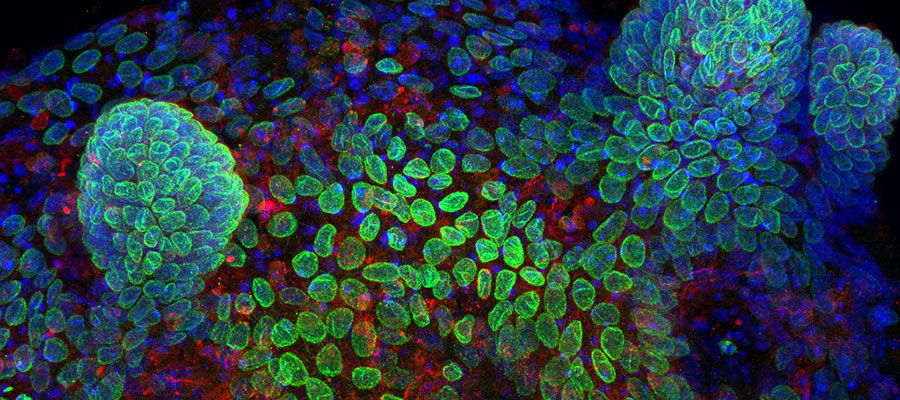 Luke Boulter Research Group | Institute of Genetics and Cancer ...