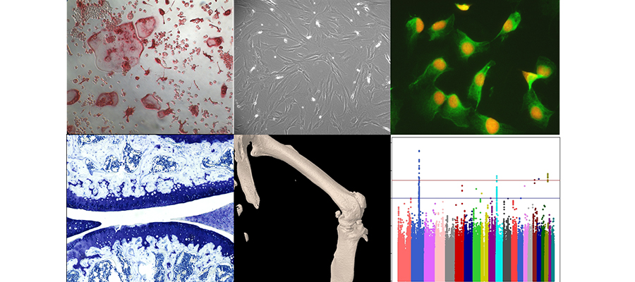 Stuart Ralston Research Group | Institute of Genetics and Cancer ...