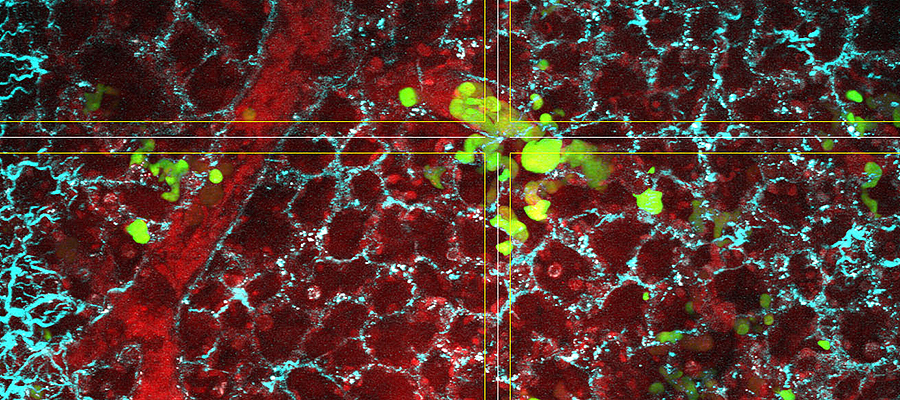 Val Brunton Research Group | Institute of Genetics and Cancer ...